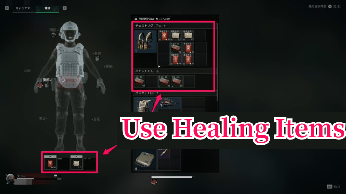 Delta Force | List of Item Effects - How to Heal HP and Injuries - GameWith